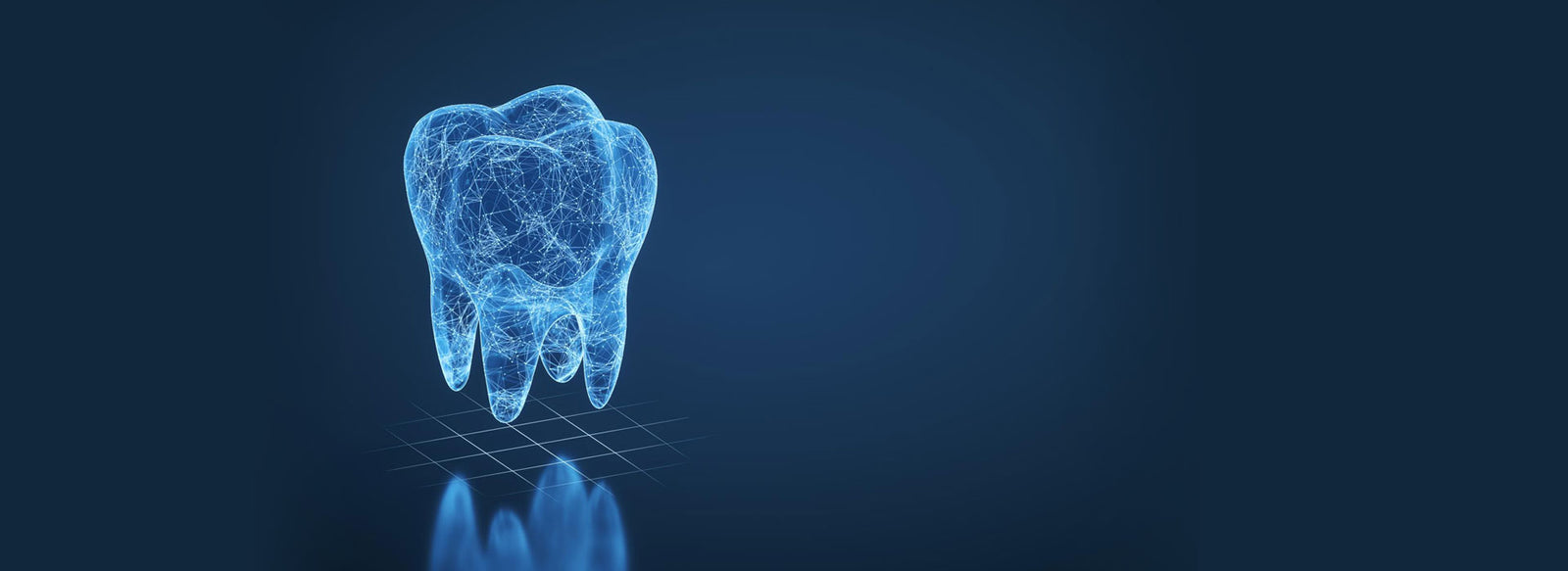 Solidex Scan Body – JB Milling Center
