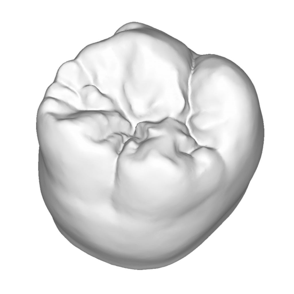 Digital Designs Crowns – JB Milling Center